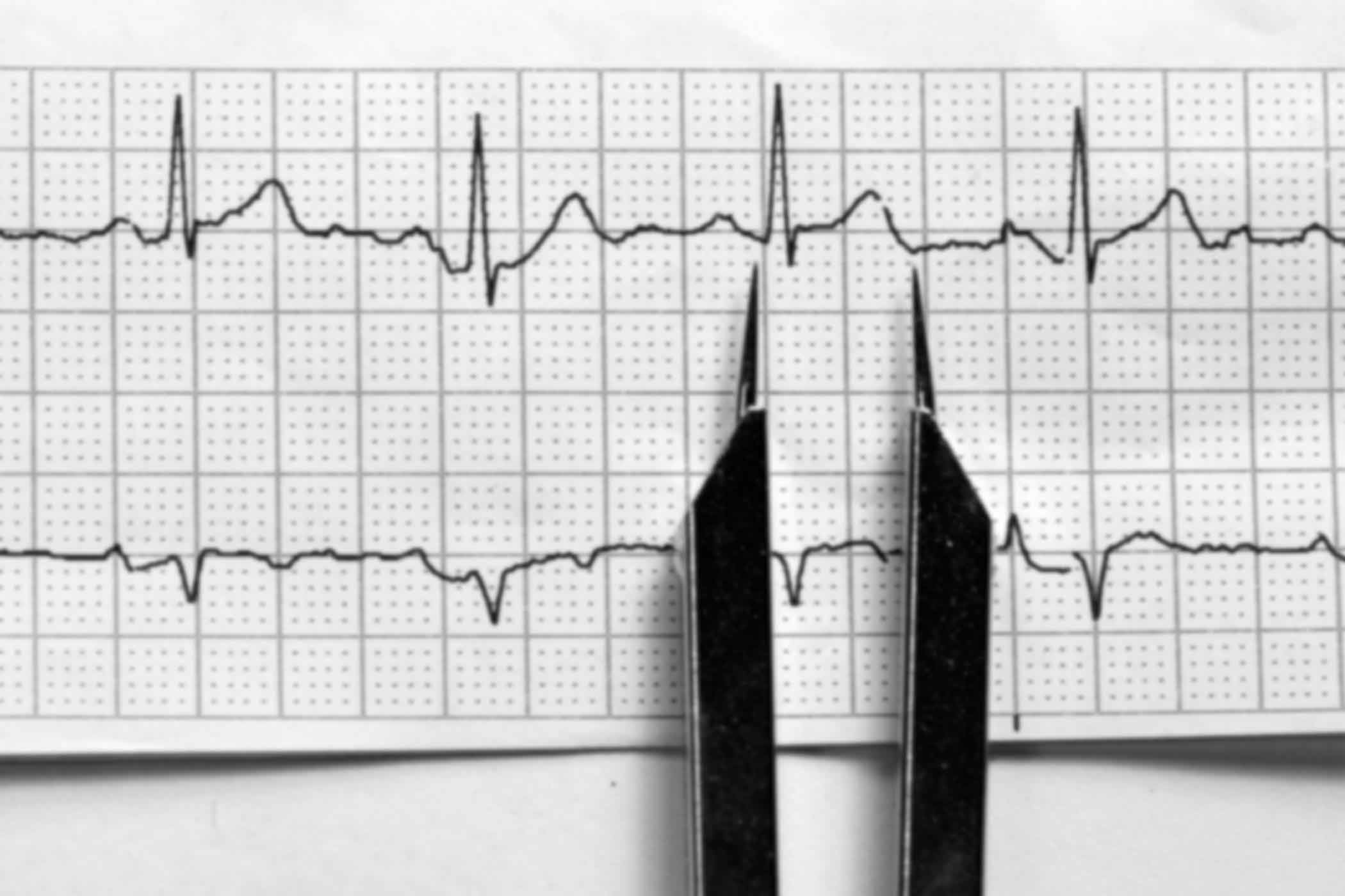 Telemetry Interpretation - RN.com