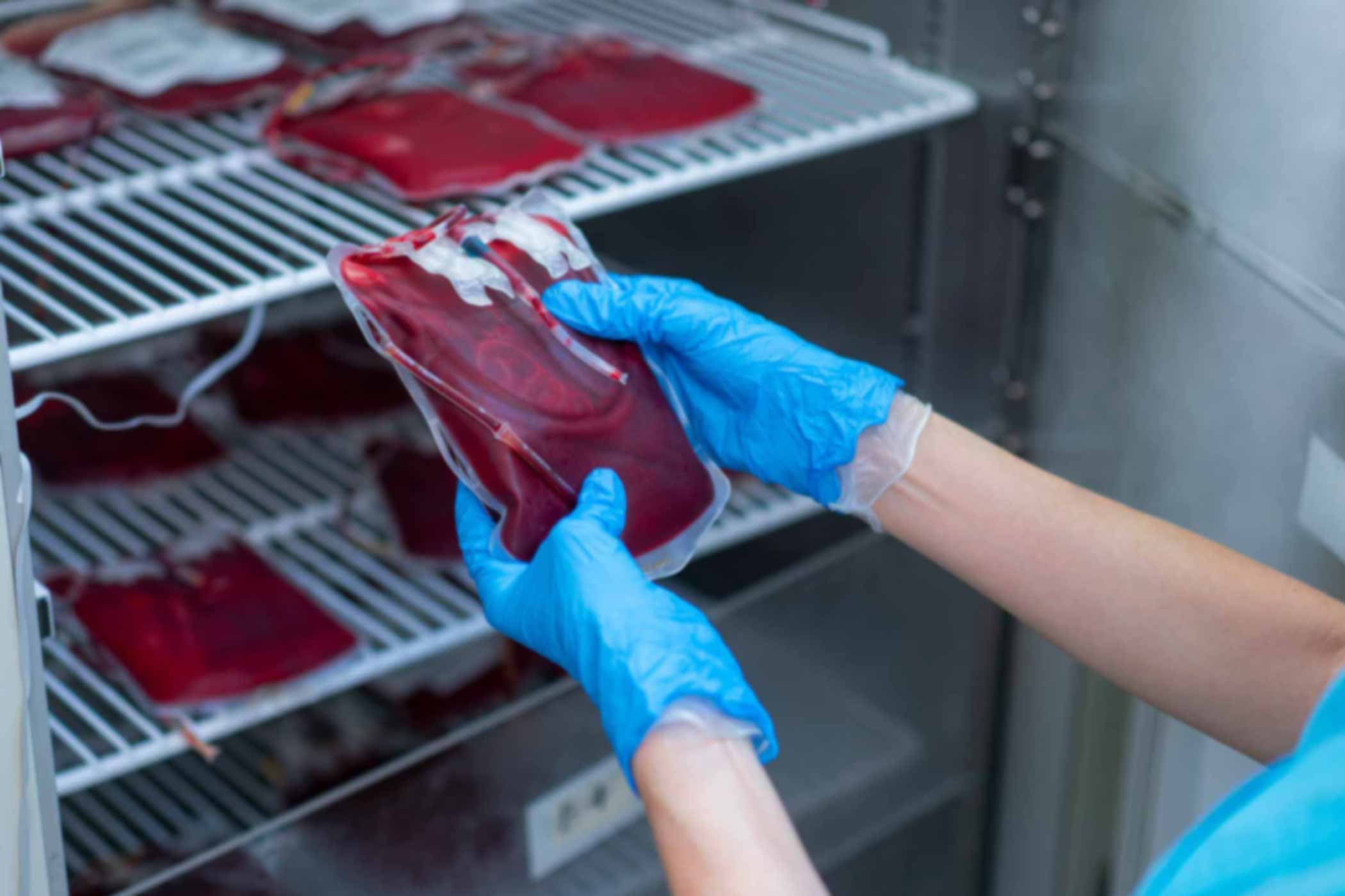 Blood Administration and Transfusion Reactions - RN.com