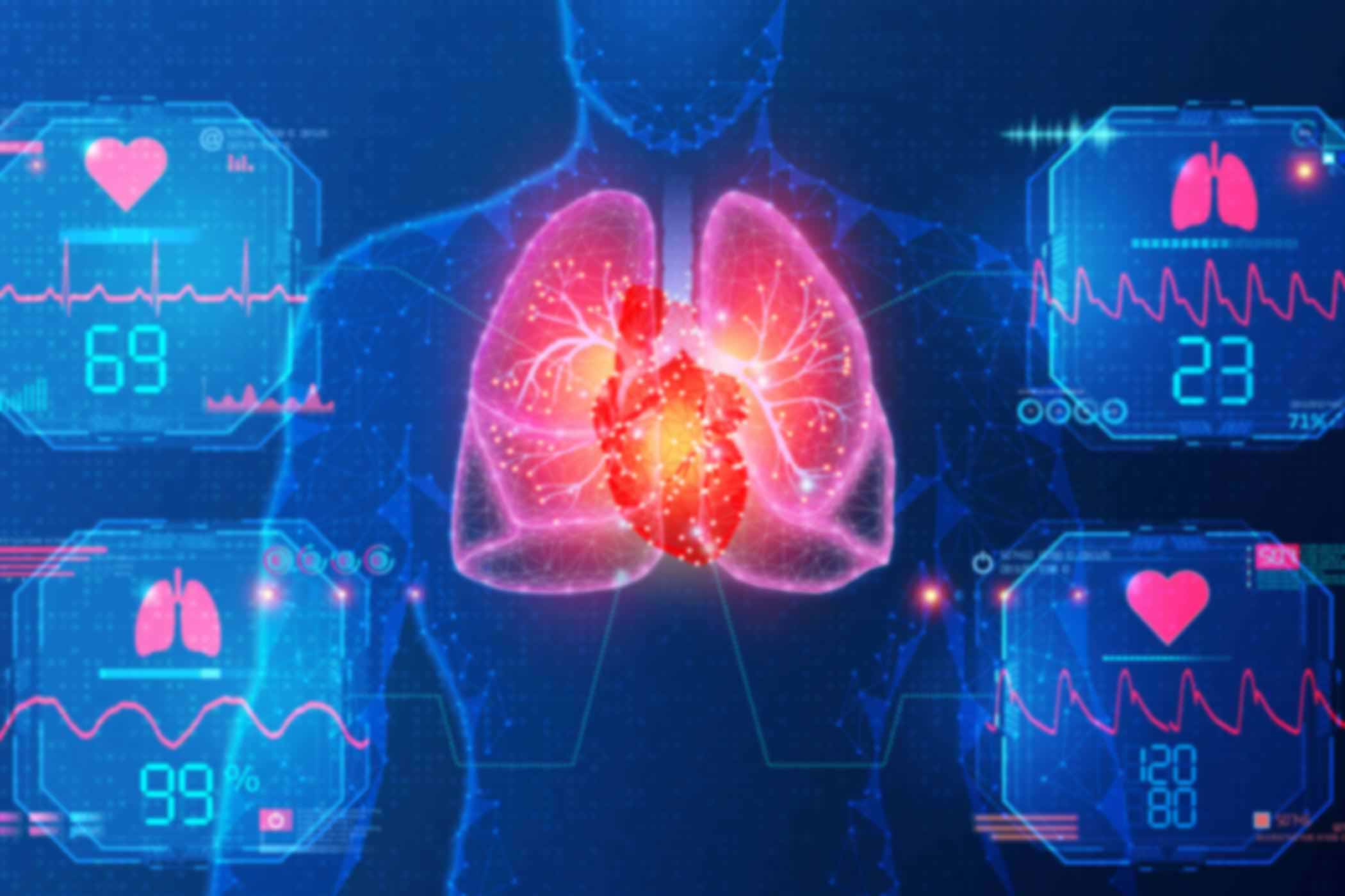 Principles of Invasive Hemodynamics - RN.com