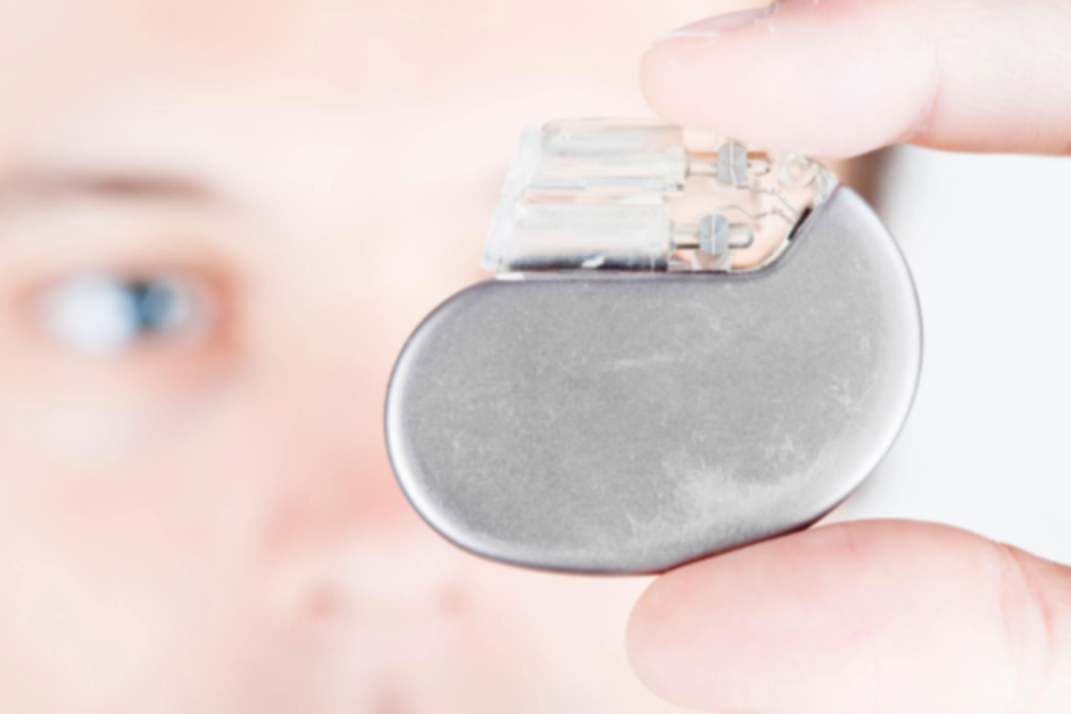 Setting the Pace: Pacemaker Principles - RN.com